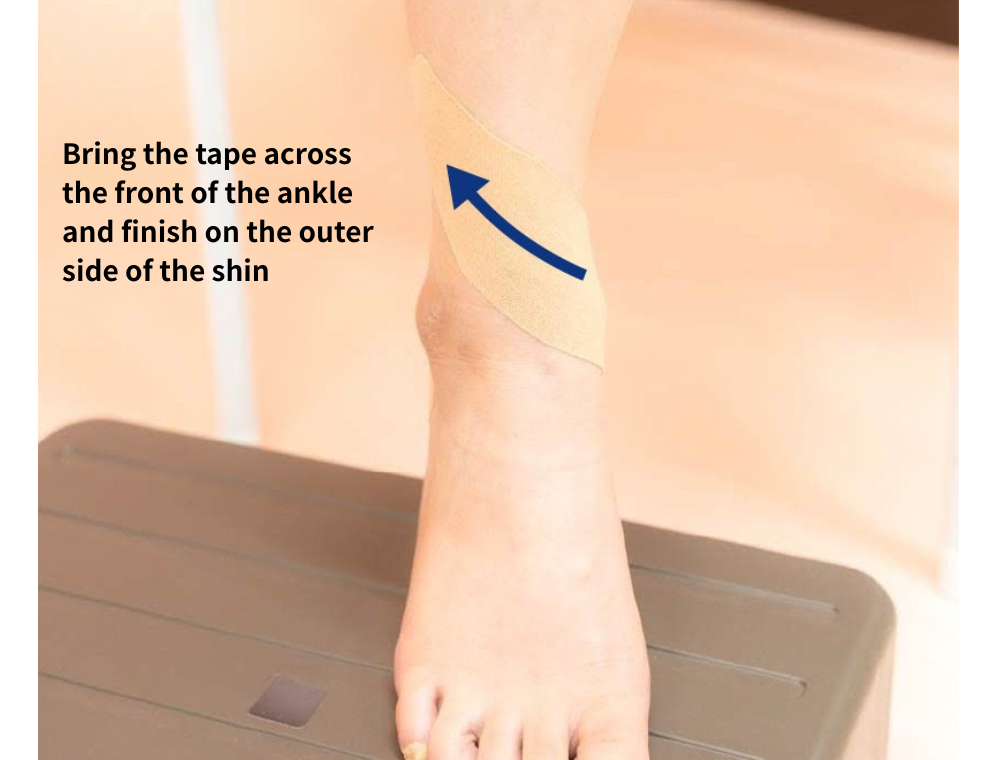 Plantar Fasciitis FAQ - OKUNO CLINIC